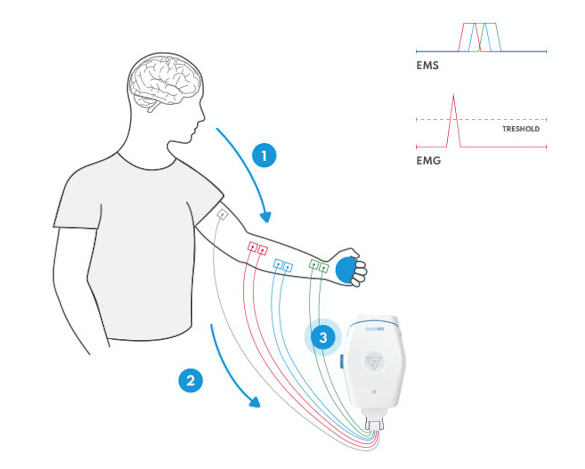 Stella Bio EMG-Triggered EMS and FES (Electrical Muscle Stimulation and ...